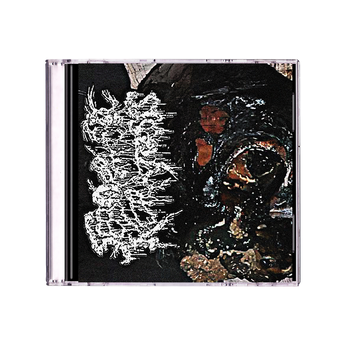 Seborrheic Keratosis - Putrefactive Regurgitation — Gore House Productions